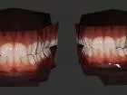 HN66s and XAZOMNs Distinctive Teeth for FO4 髪・顔・体 - Fallout4 Mod データベース ...