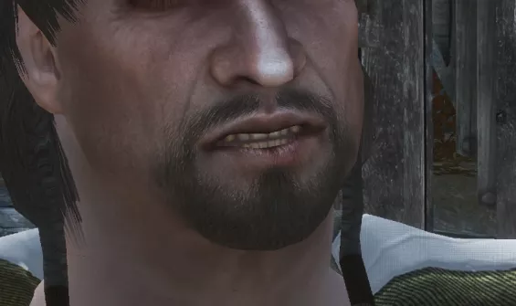 Natural Teeth 髪・顔・体 - Skyrim Mod データベース MOD紹介・まとめサイト